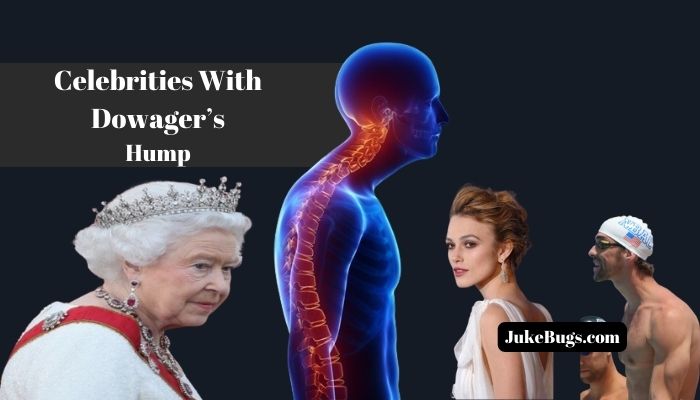10 Celebrities With Dowager's Hump